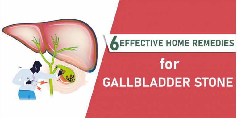 6 Effective Home Remedies For Gallbladder Stone | Shuddhi Ayurveda