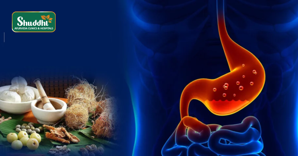 Top 10 Ayurvedic Home Remedies by Shuddhi Ayurveda to Cure Acidity and ...